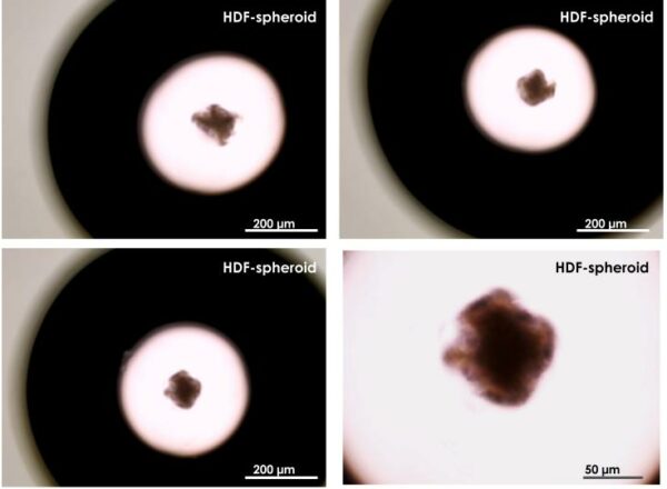 Cell aggregation: spheroid formation with hanging drop technique - labmethods